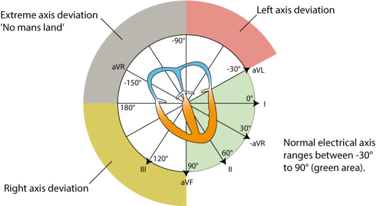 The electrical axis of the heart (heart axis): ECG & physiology ...