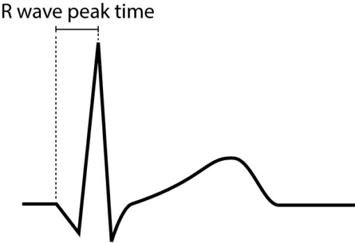 The QRS complex: ECG features of the Q-wave, R-wave, S-wave & duration ...