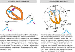 P-wave, PR interval, PR segment: physiology, criteria & ECG findings ...