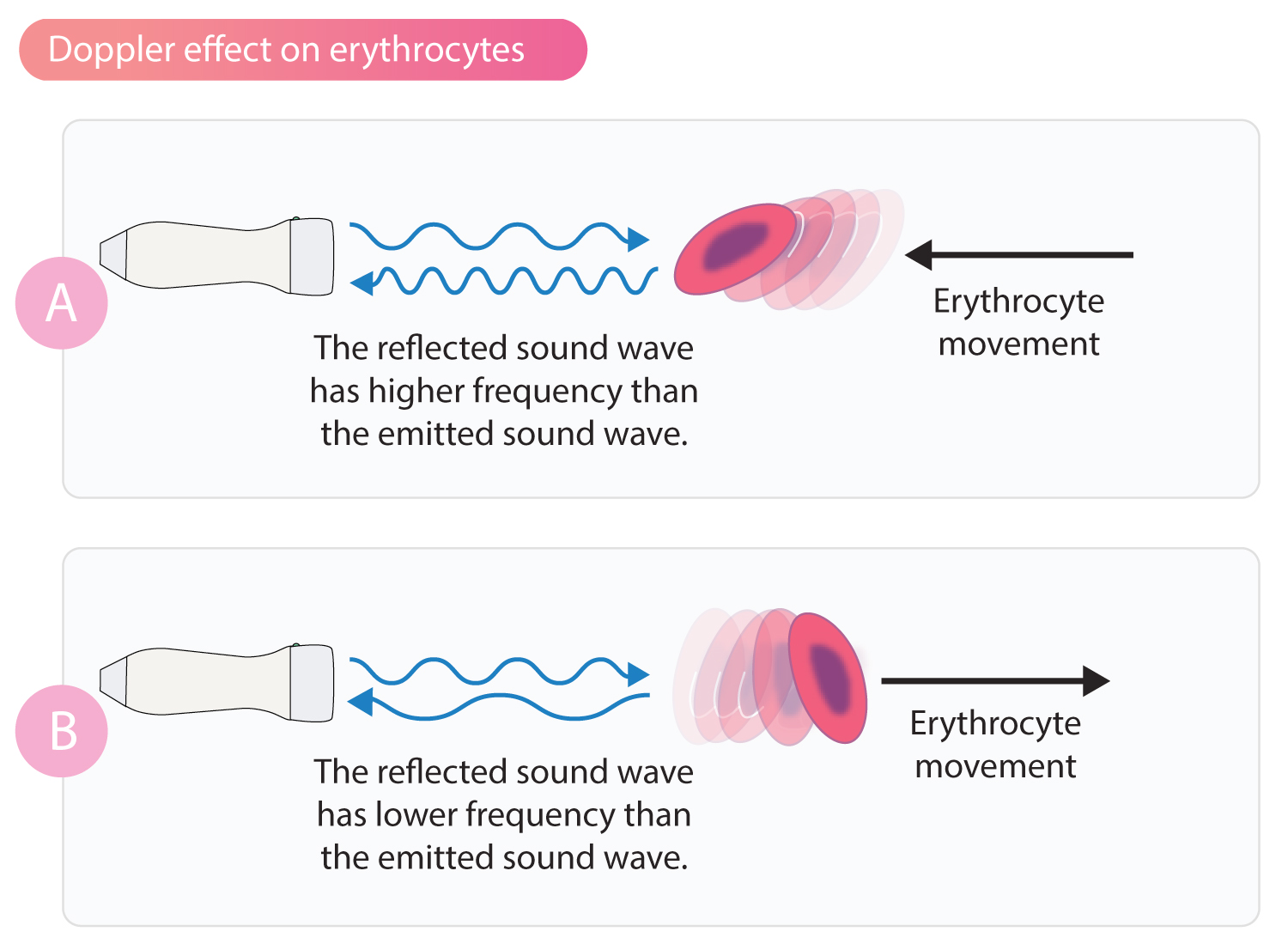 Doppler-Effekt und Doppler-Echokardiographie – EKG & ECHO
