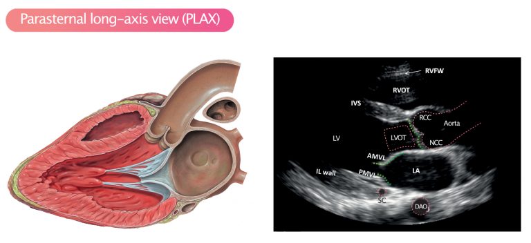 Die echokardiographische Standarduntersuchung: Ein vollständiges ...