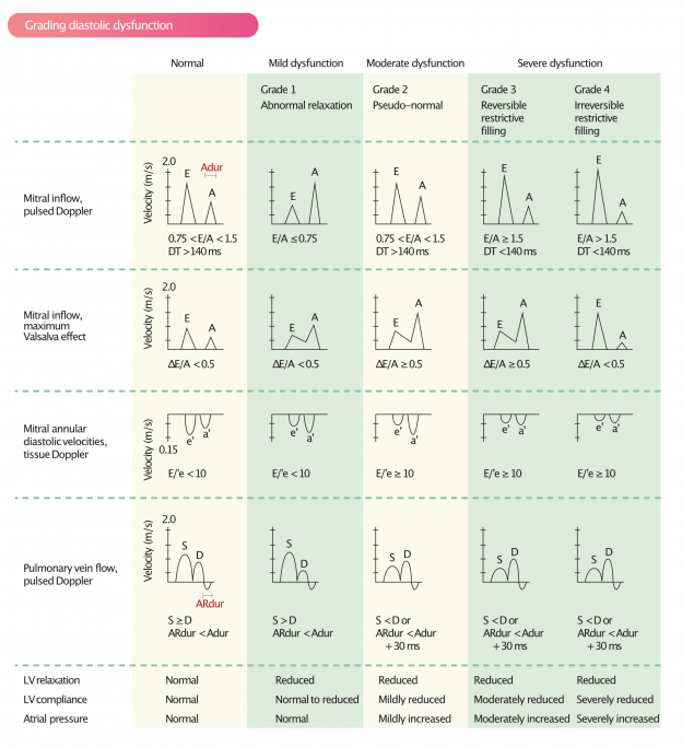 Beurteilung der diastolischen Funktion mittels Echokardiographie – EKG ...