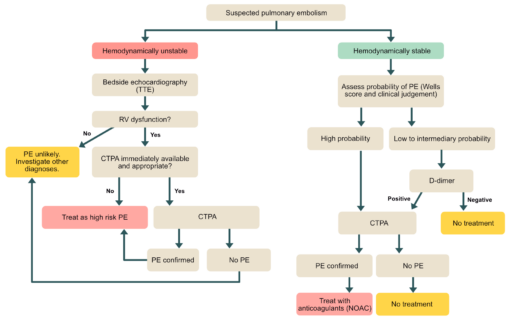 Pulmonary Embolism (PE): Causes, symptoms, diagnosis, treatment