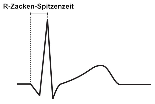 EKG-Interpretation: Merkmale des normalen EKGs (P-Welle, QRS-Komplex ...