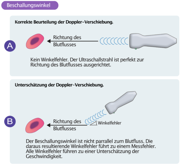 Doppler-Effekt und Doppler-Echokardiographie – EKG & ECHO
